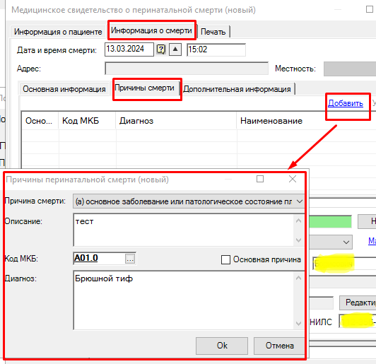 СЭМД «Медицинское свидетельство о перинатальной смерти РМИС НАО